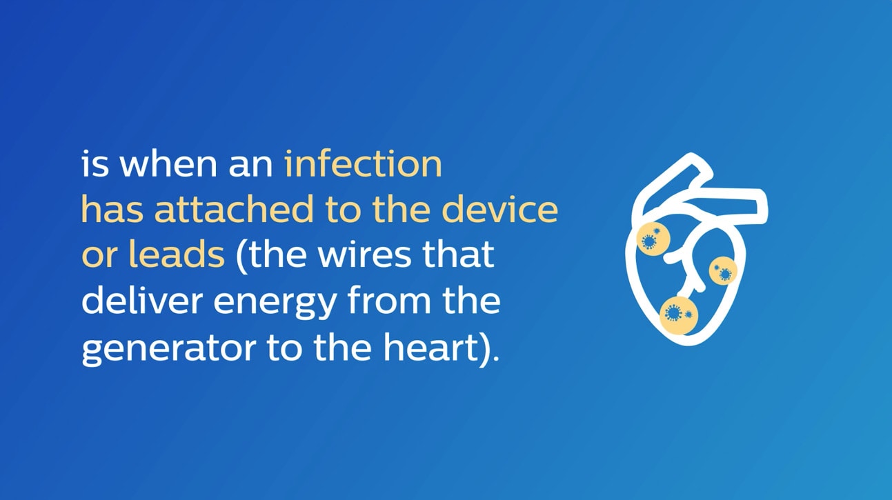 CIED Device Infection and Lead Extraction | Philips